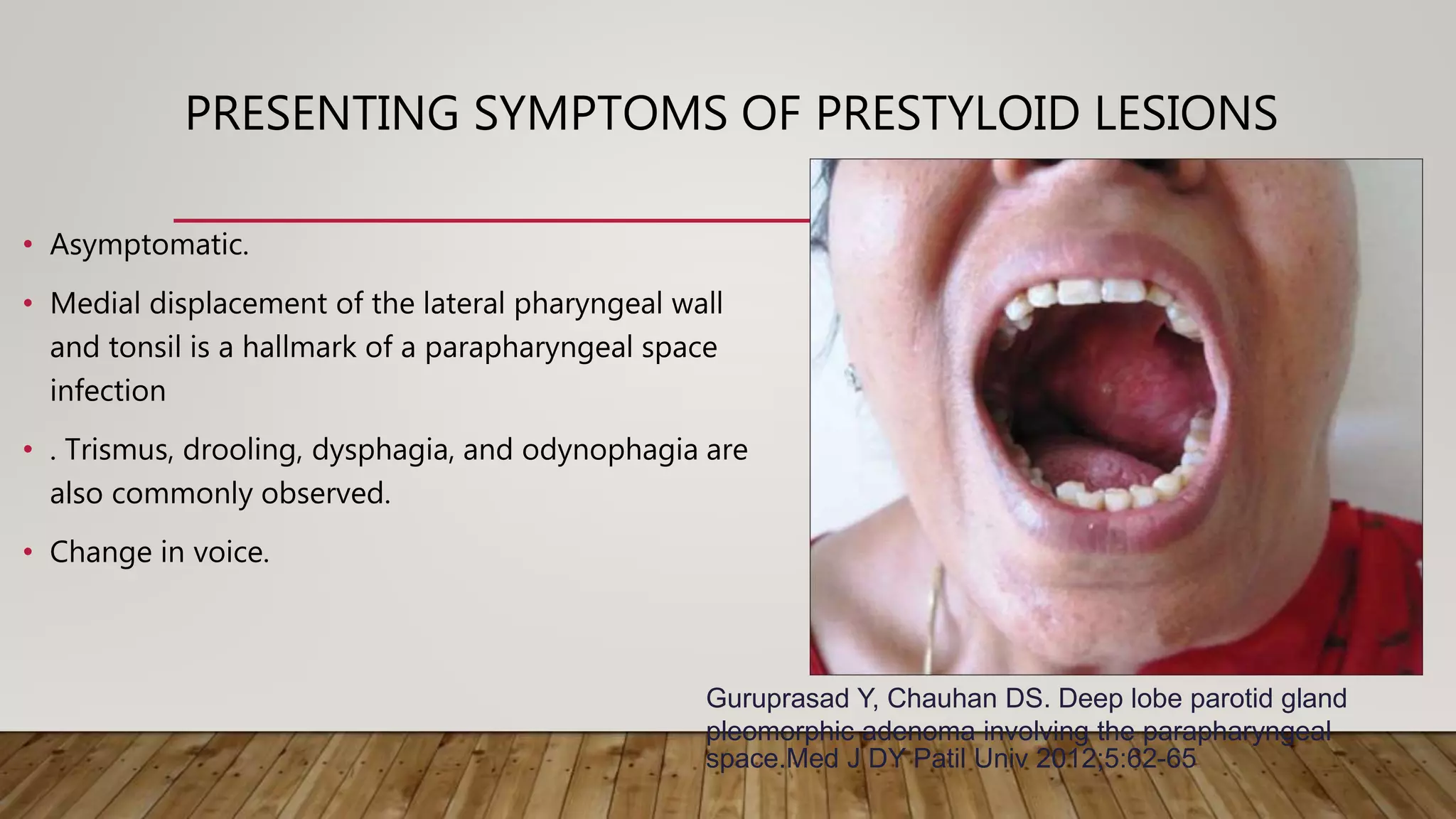 Parapharyngeal space | PPTX