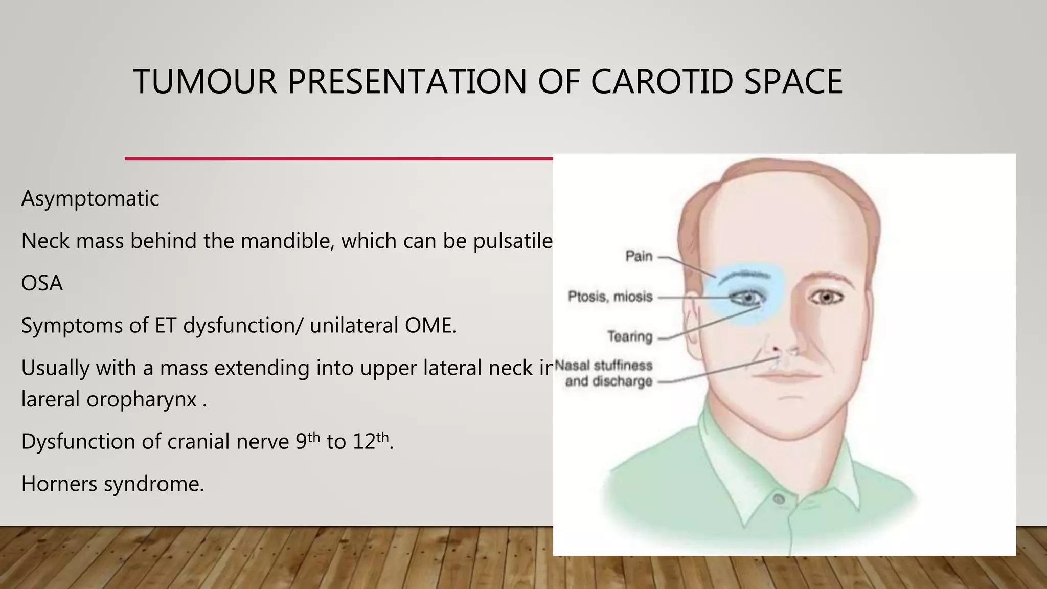 Parapharyngeal space | PPTX