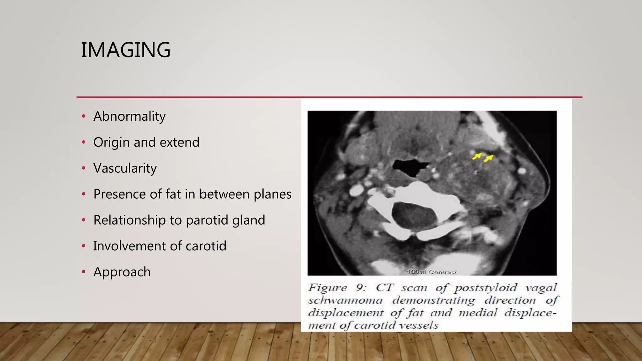 Parapharyngeal space | PPTX