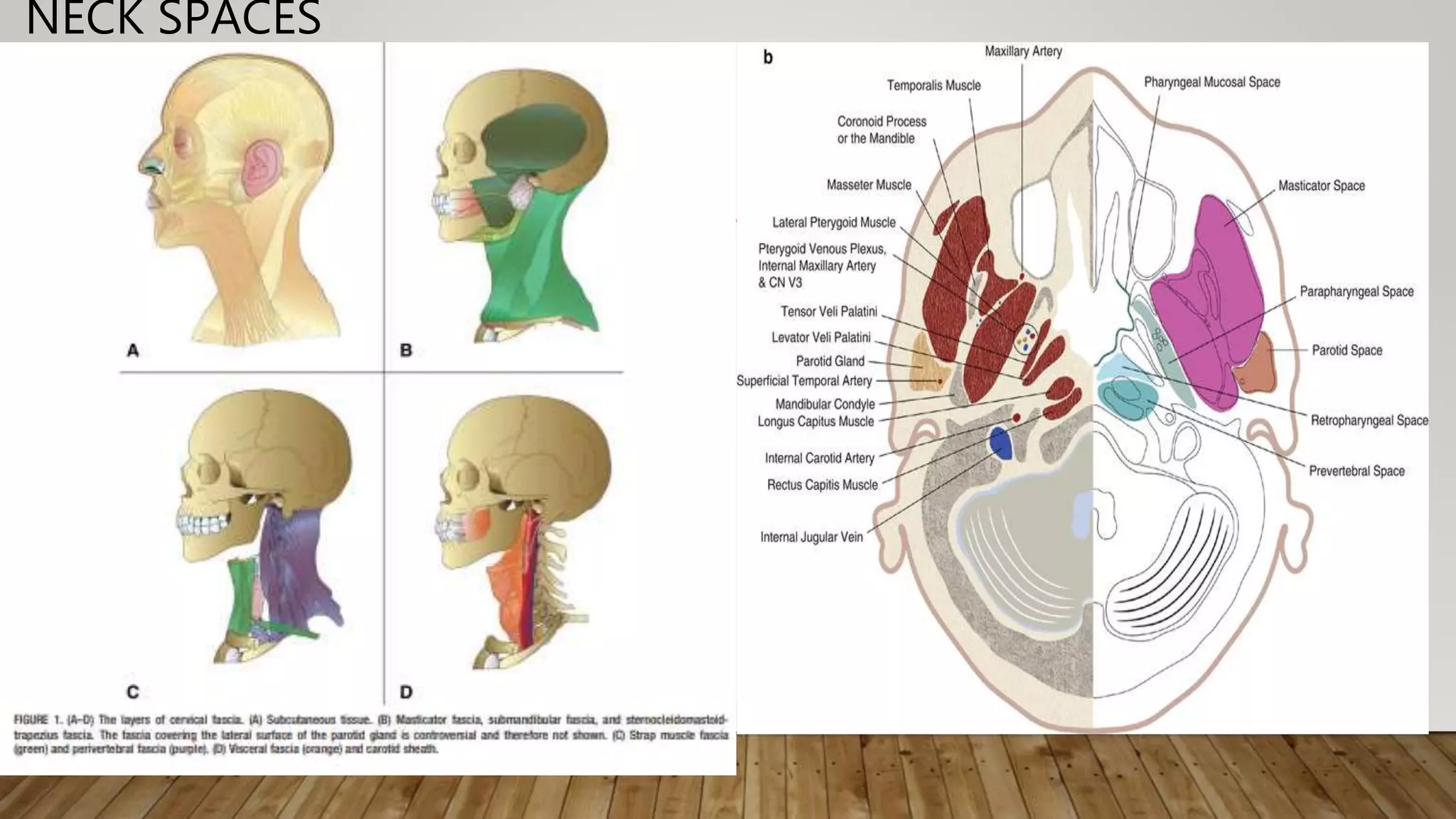Parapharyngeal space | PPTX