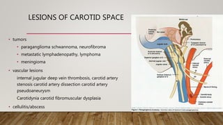 Parapharyngeal space | PPTX