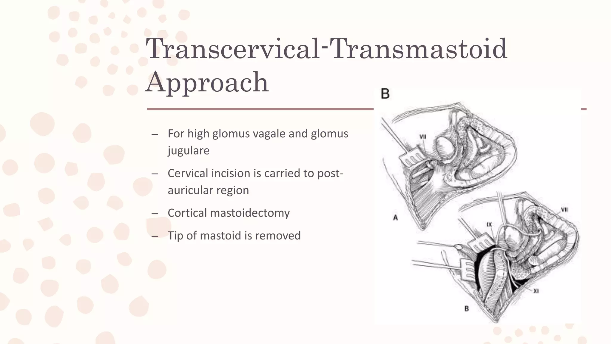 Parapharyngeal tumors | PPTX