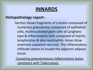 Paraplegia a textbook case | PPT