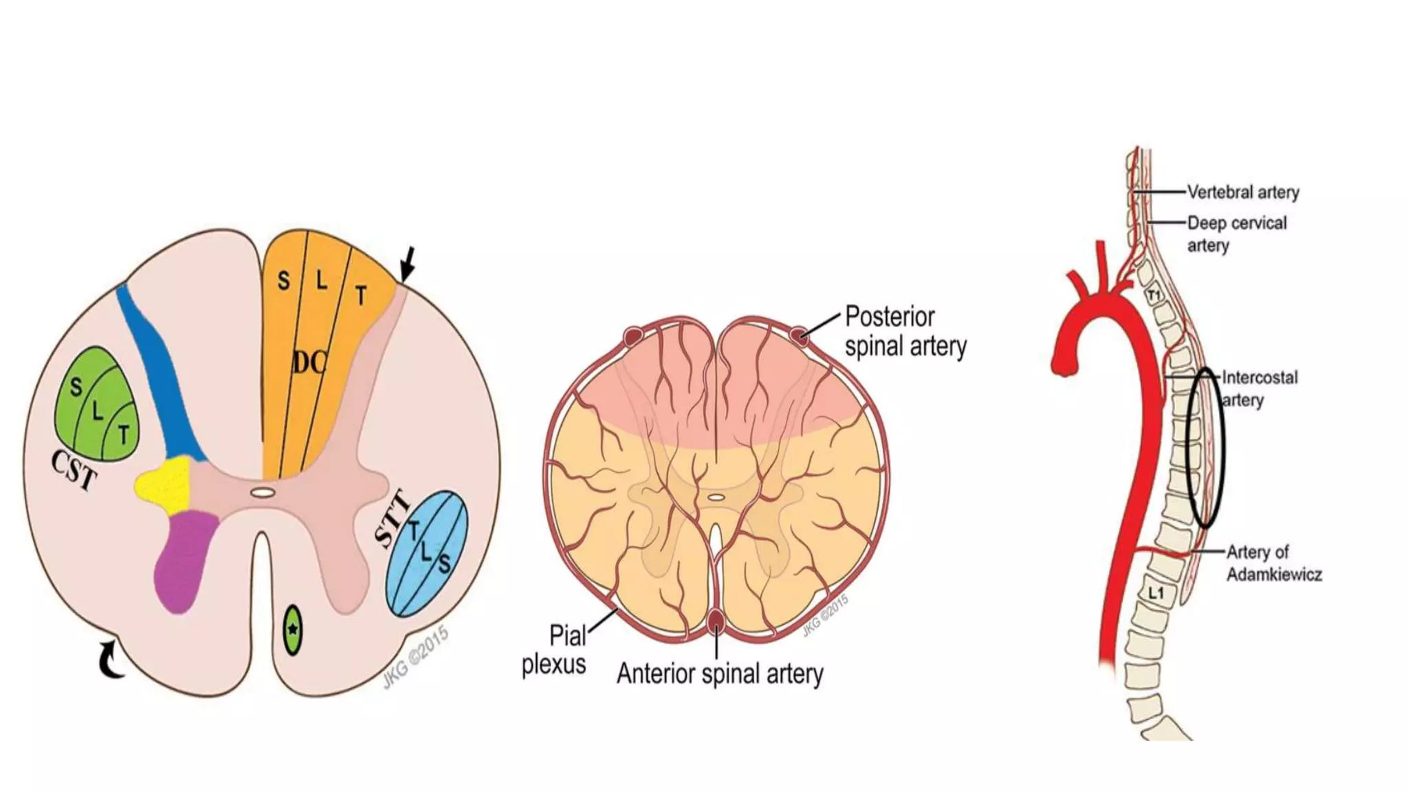 Paraplegia And Spinal Cord Syndromes Ppt