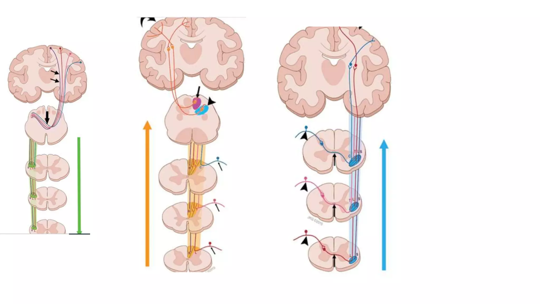 Paraplegia And Spinal Cord Syndromes Ppt