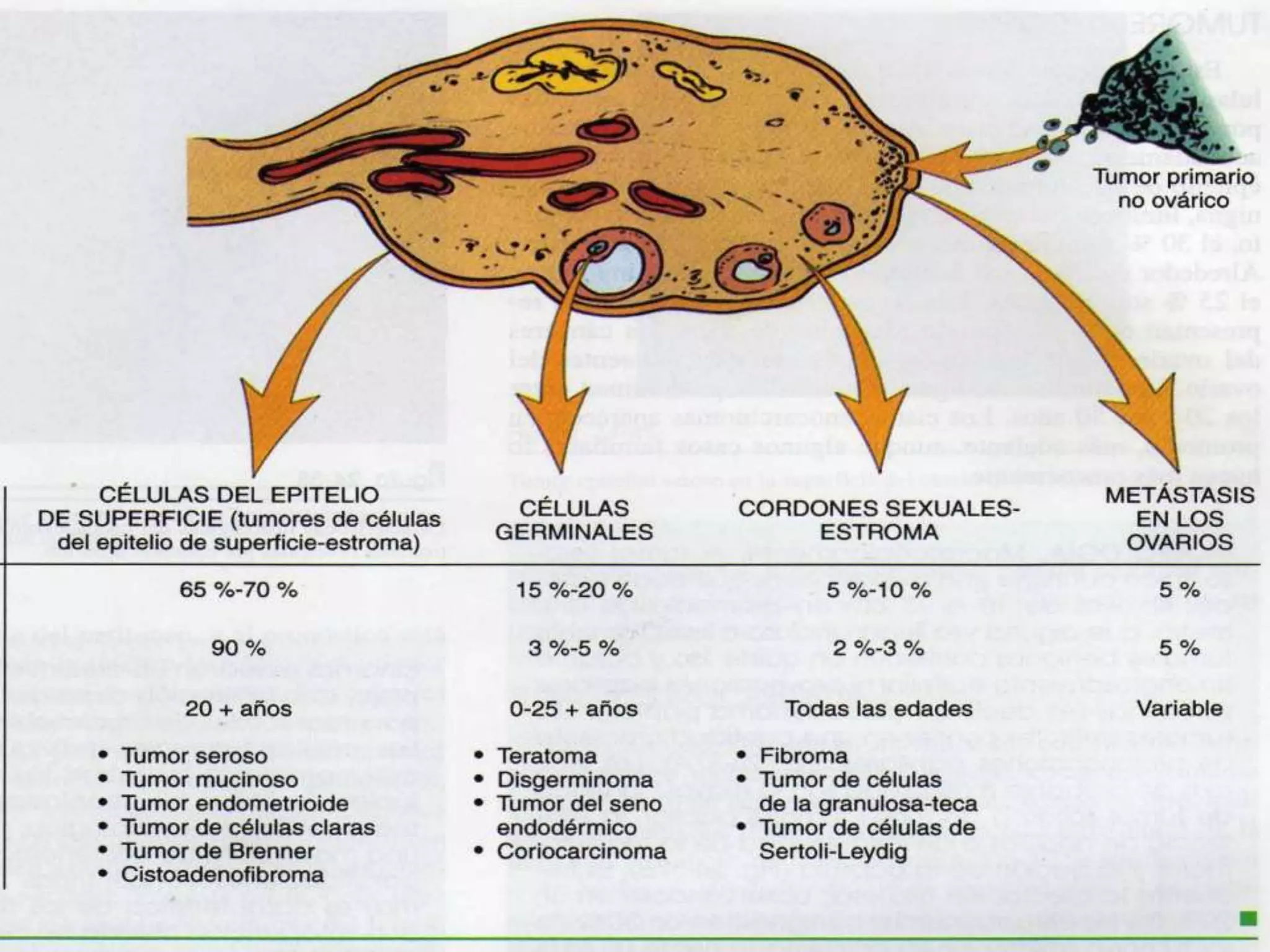 Cáncer de Ovario y Patología de Salpinge | PPT