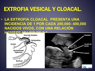 Ultrasonido Extrofia Vesical