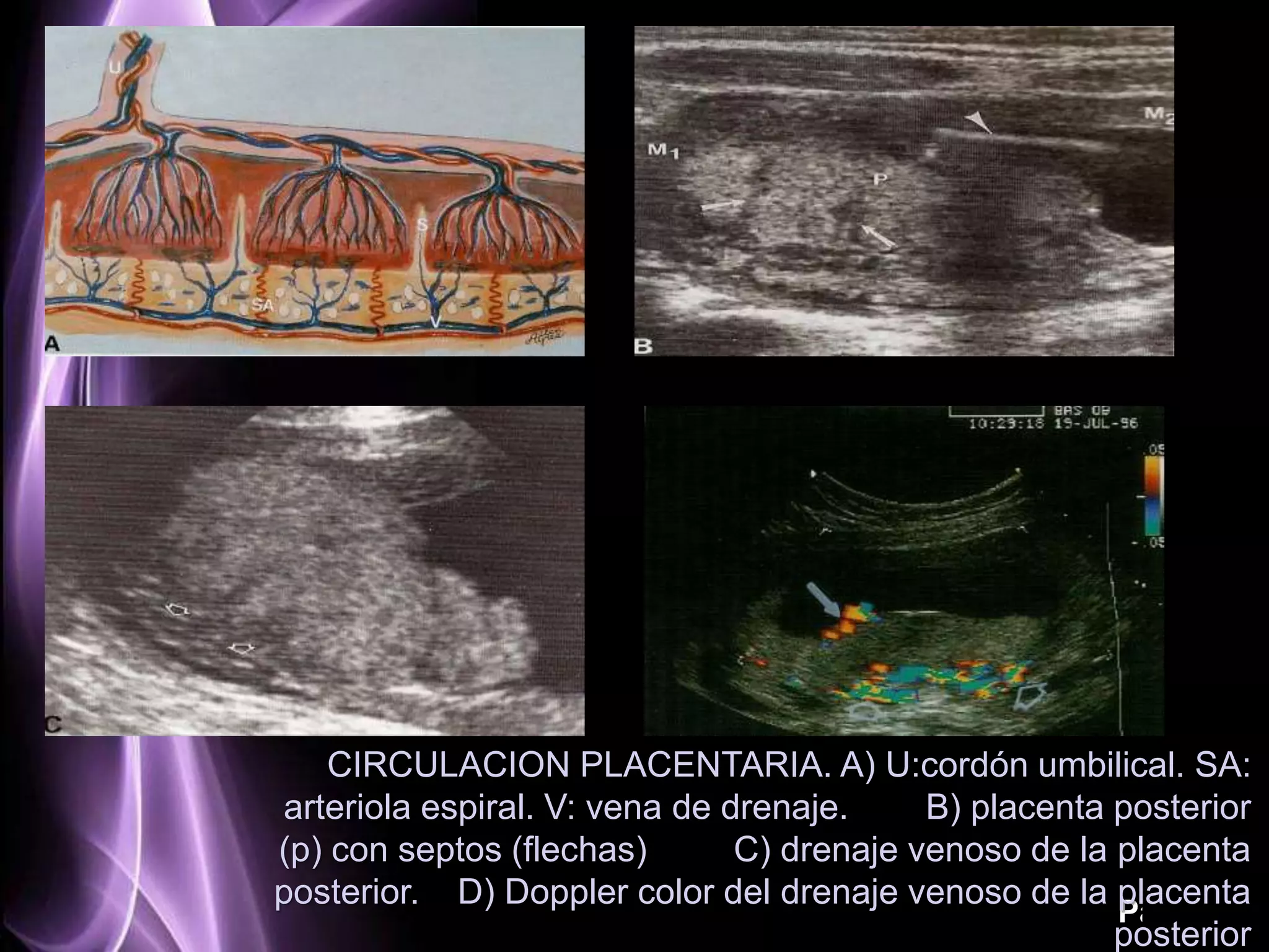 ECOGRAFÍA NORMAL Y PATOLOGÍA DE LA PLACENTA Y CORDÓN UMBILICAL | PPTX