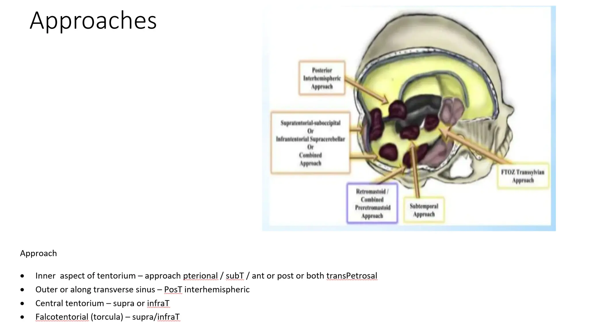 Parasagittal,Falcine,TentoralMeningioma.pptx