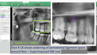 Parashar PaX-i Insight | PPT