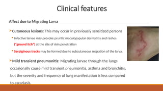Parasite and parasitism, classification of protozoans & helminths- II.pptx