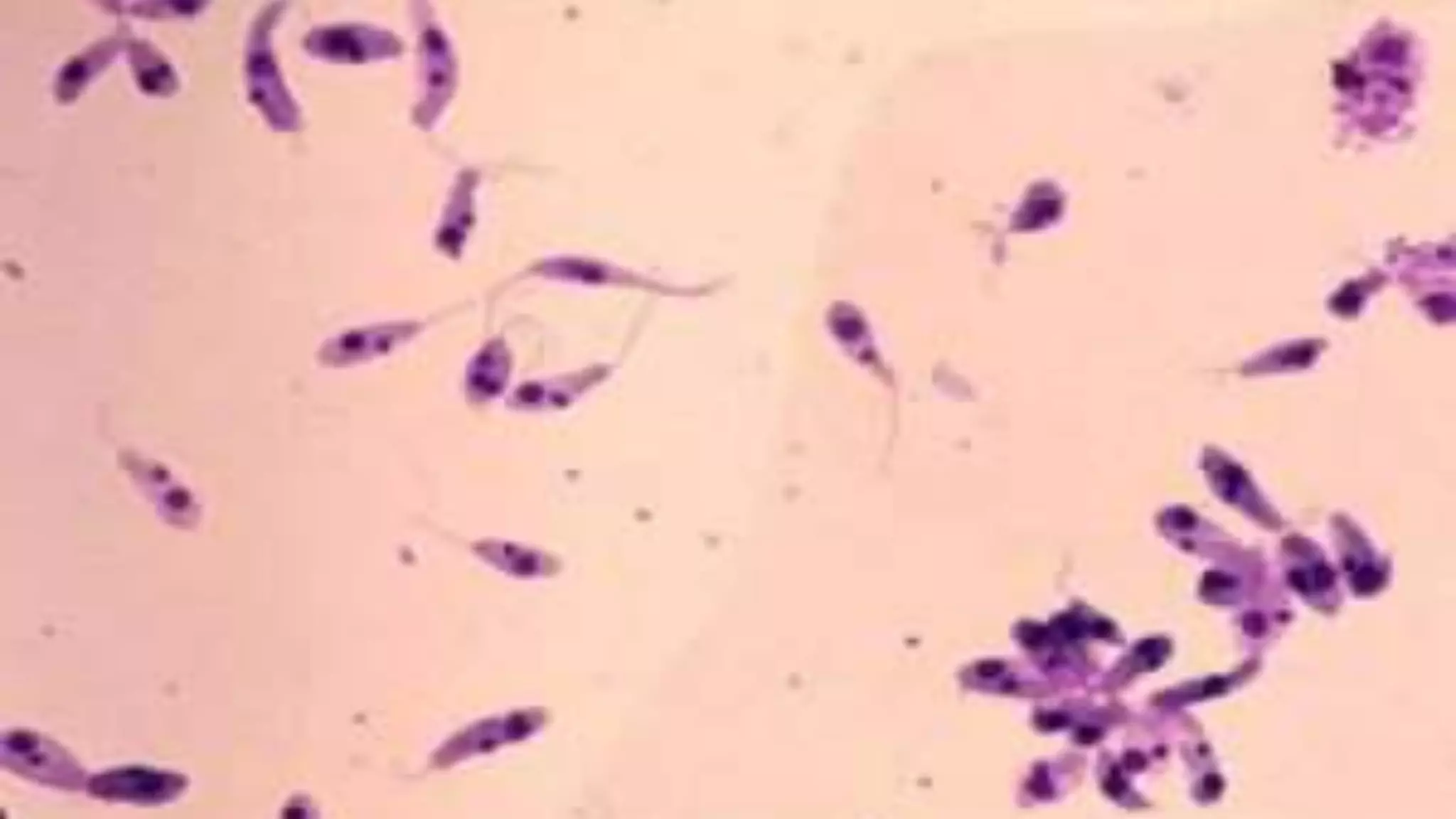 Parasite culture | PPTX