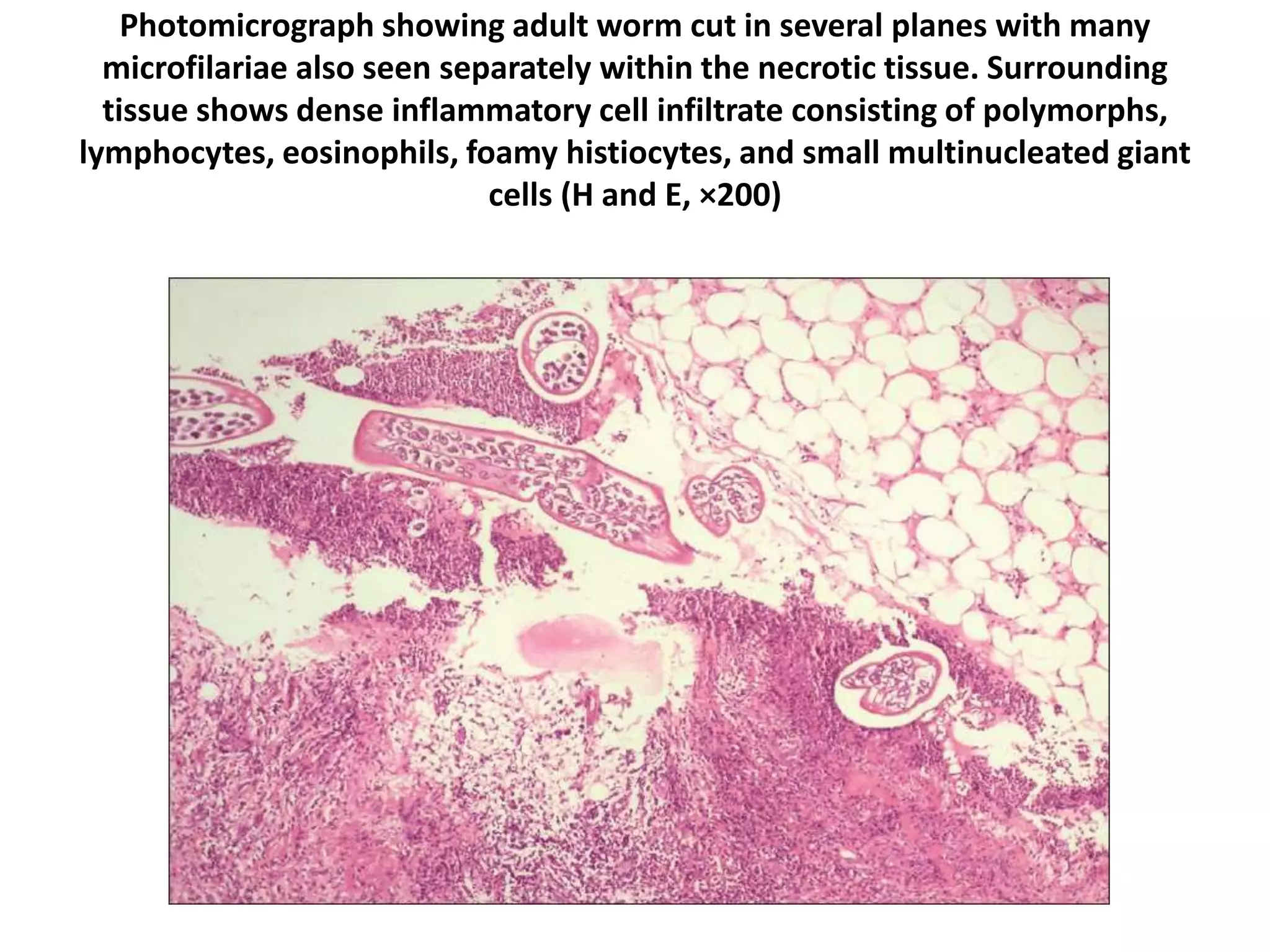 Parasites in histopathology | PPTX