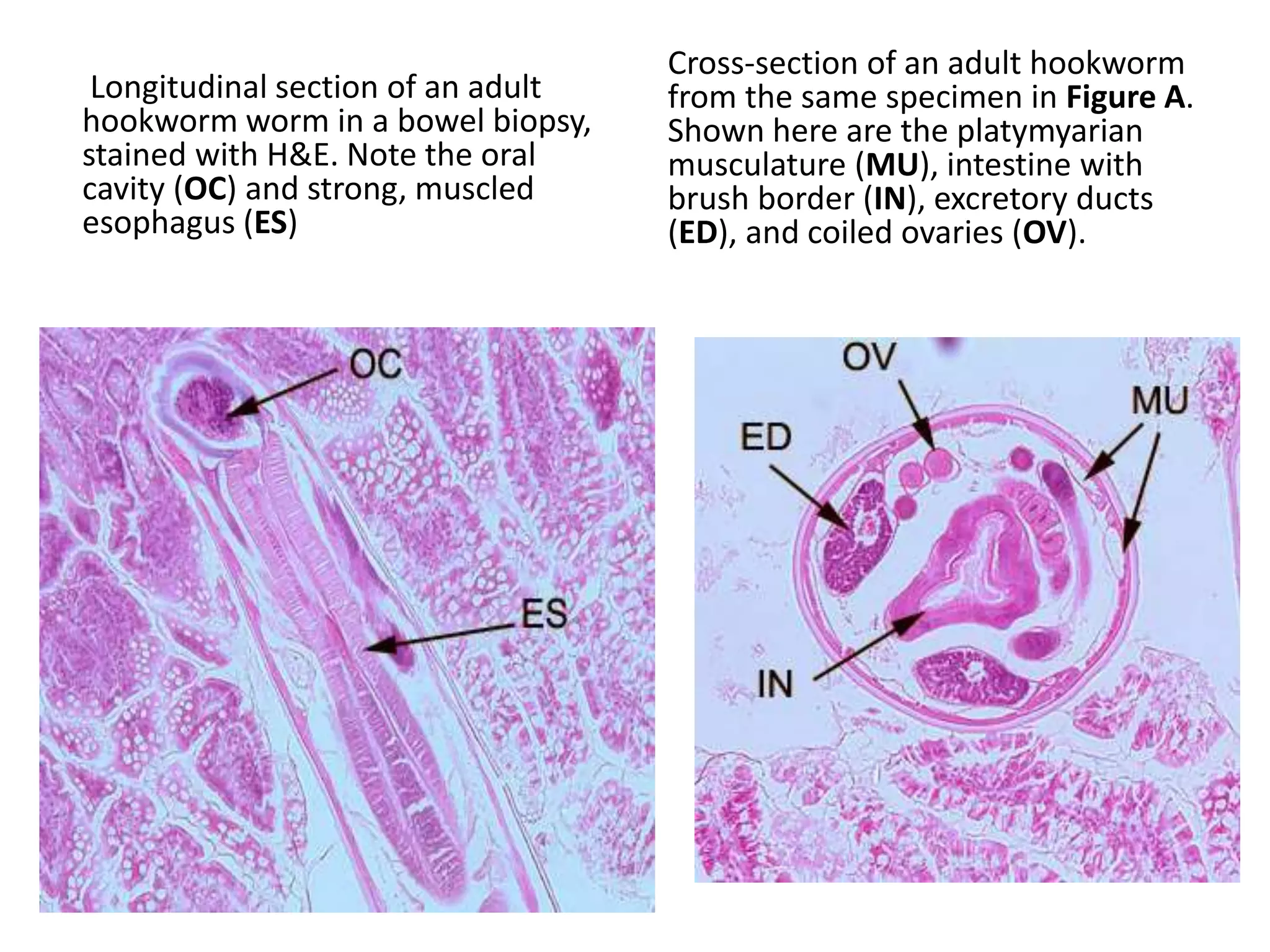 Parasites in histopathology