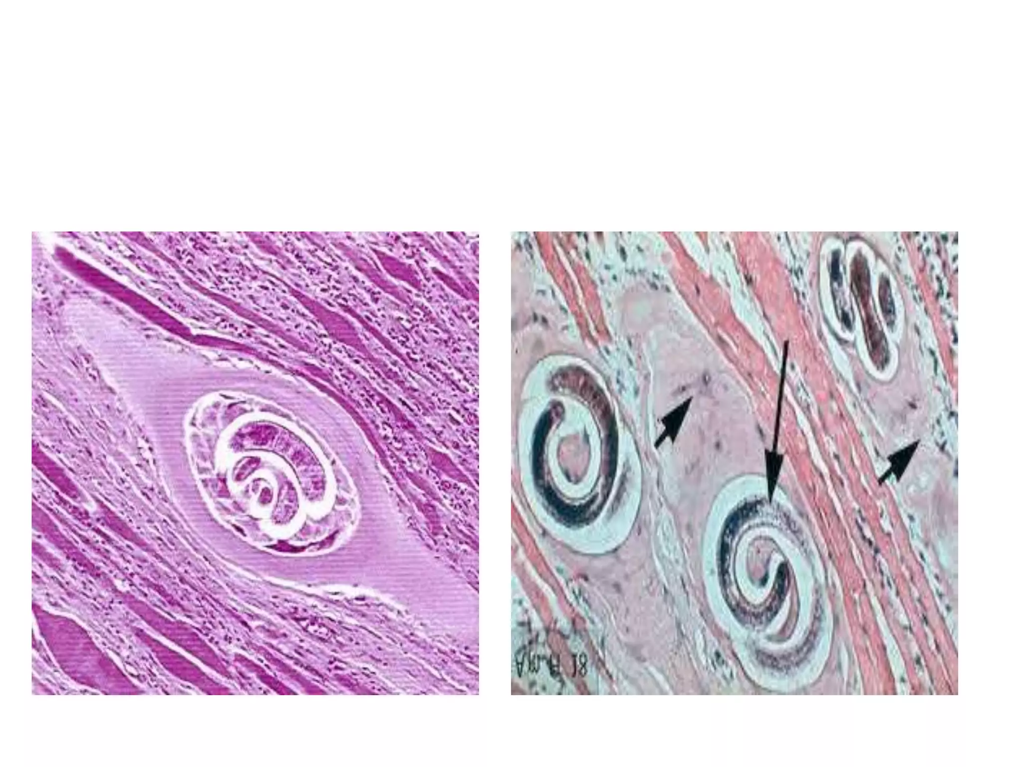 Parasites in histopathology