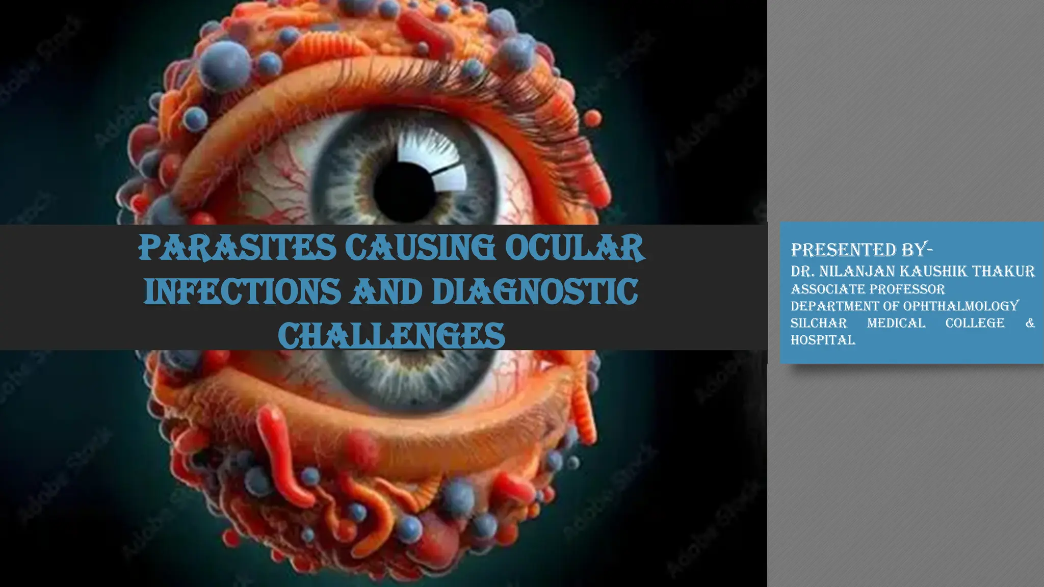 parasites involved in ocular infection.pptx