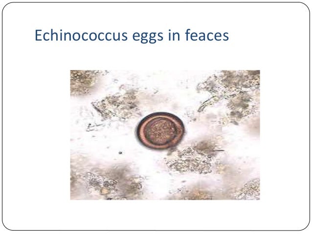 Echinococcus granulosus