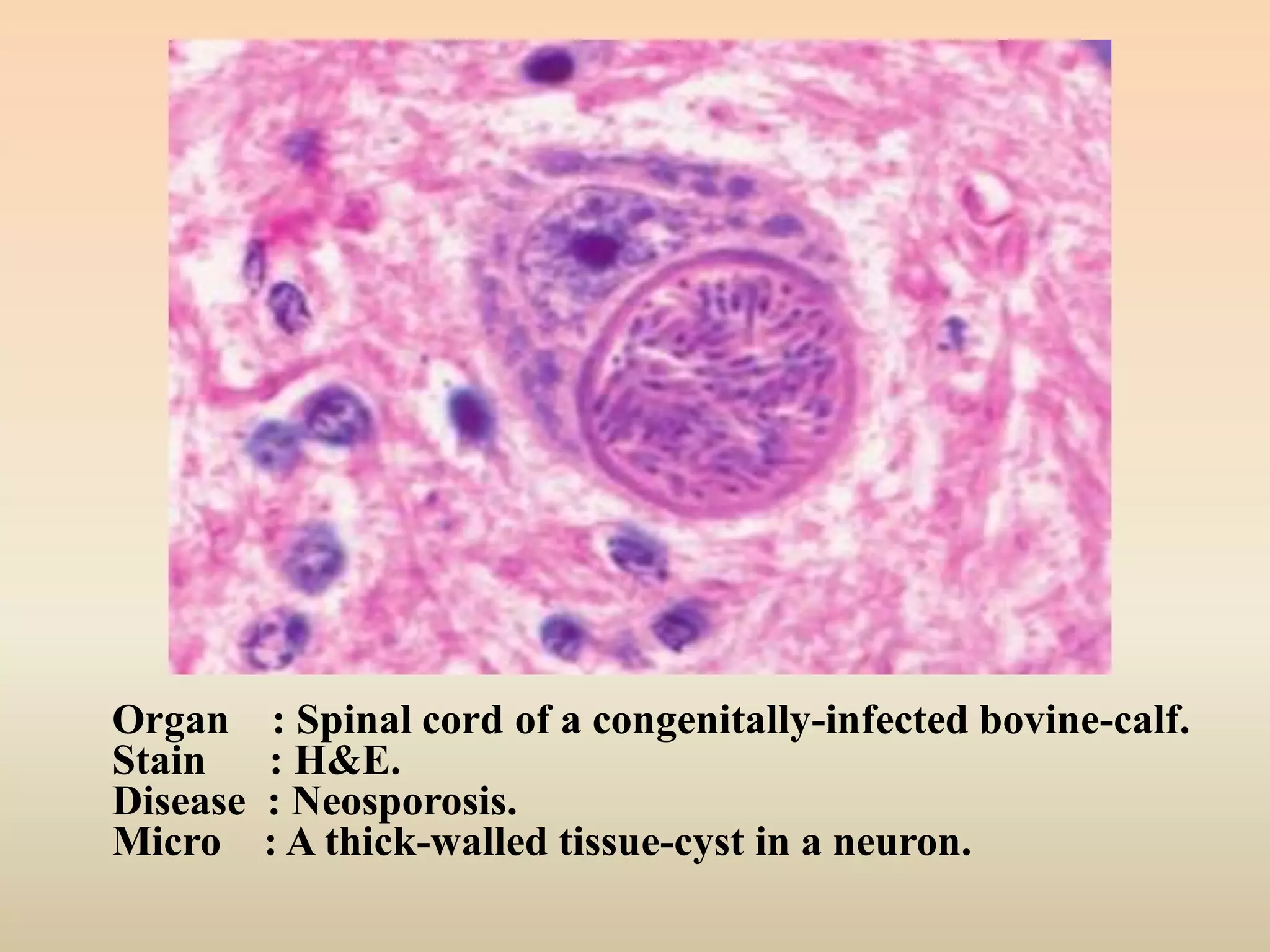 pathology of Parasitic diseases | PDF