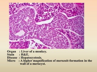 pathology of Parasitic diseases | PDF