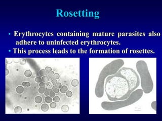 Clinical Aspects of Malaria | PPTX
