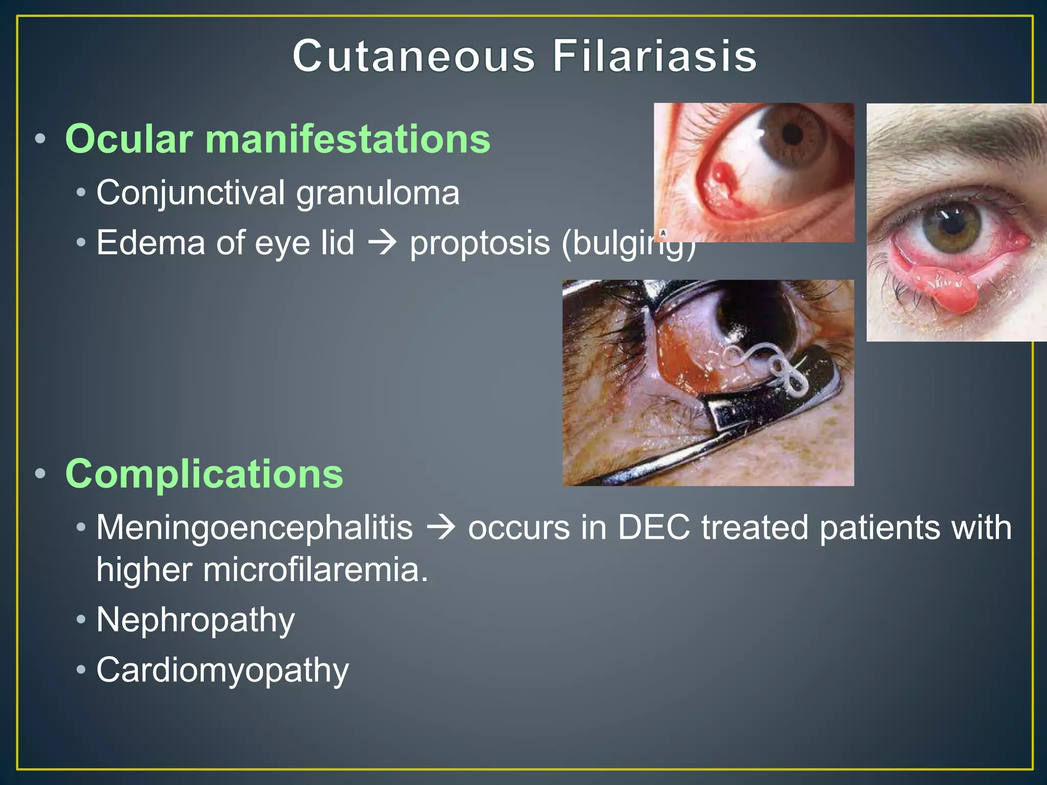 Parasitic infection of Skin, Soft tissue and Muskuloskeletal tissues.pptx