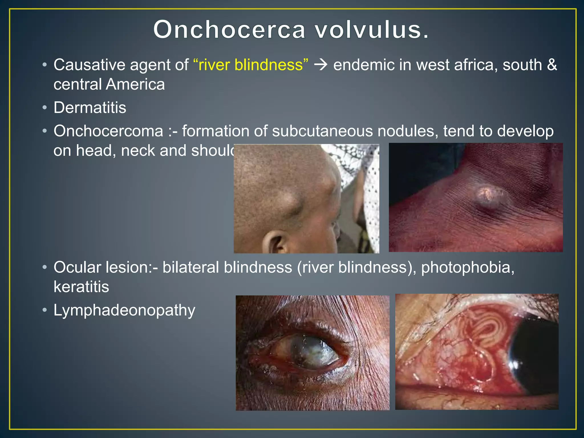 Parasitic infection of Skin, Soft tissue and Muskuloskeletal tissues.pptx