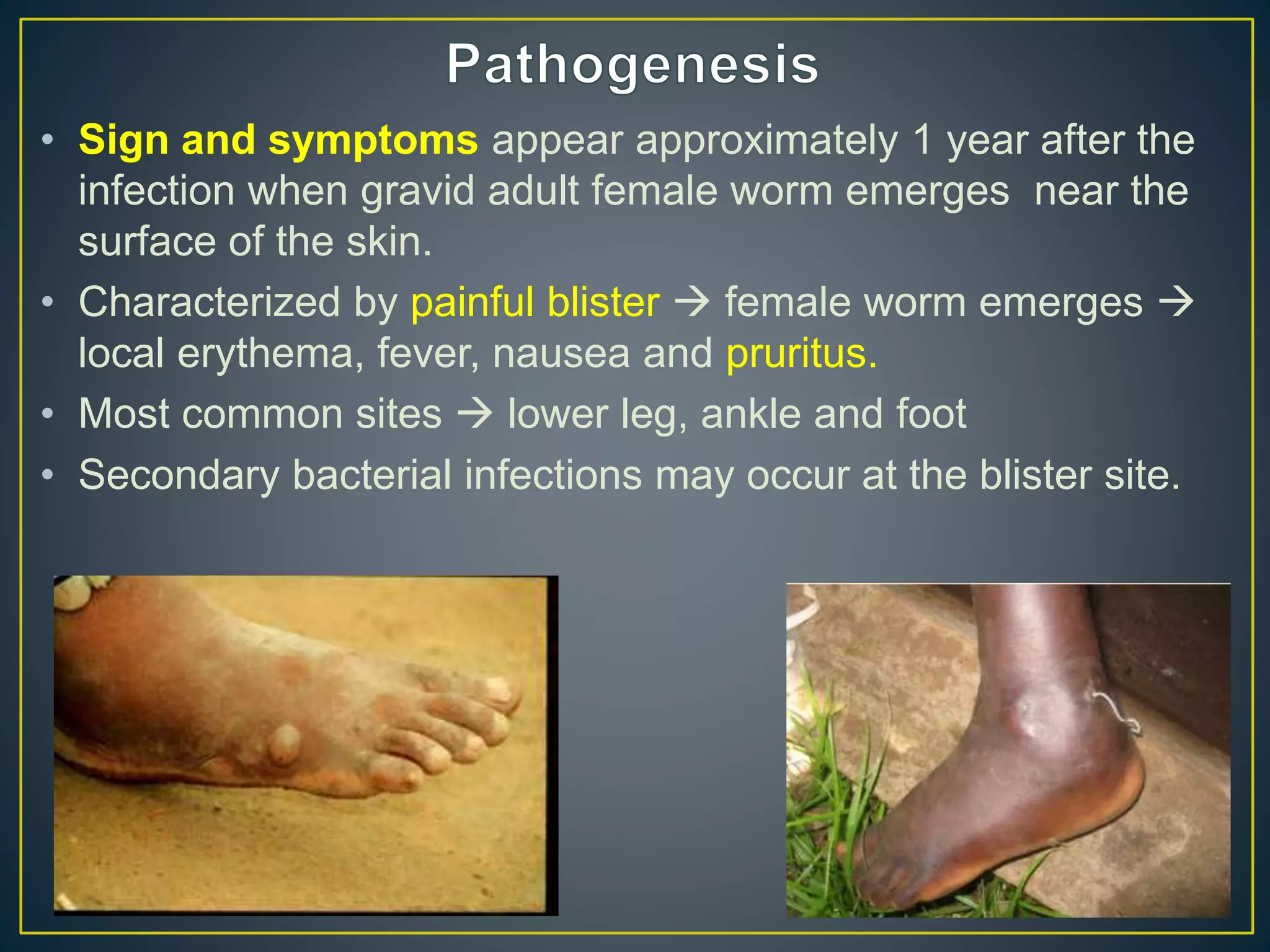 Parasitic infection of Skin, Soft tissue and Muskuloskeletal tissues.pptx