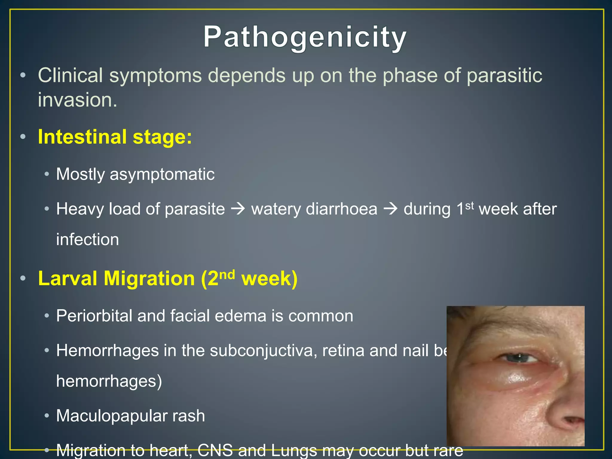 Parasitic infection of Skin, Soft tissue and Muskuloskeletal tissues.pptx