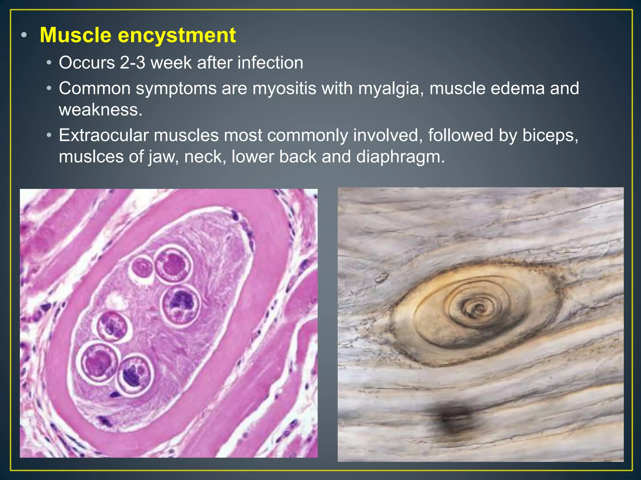 Parasitic infection of Skin, Soft tissue and Muskuloskeletal tissues.pptx