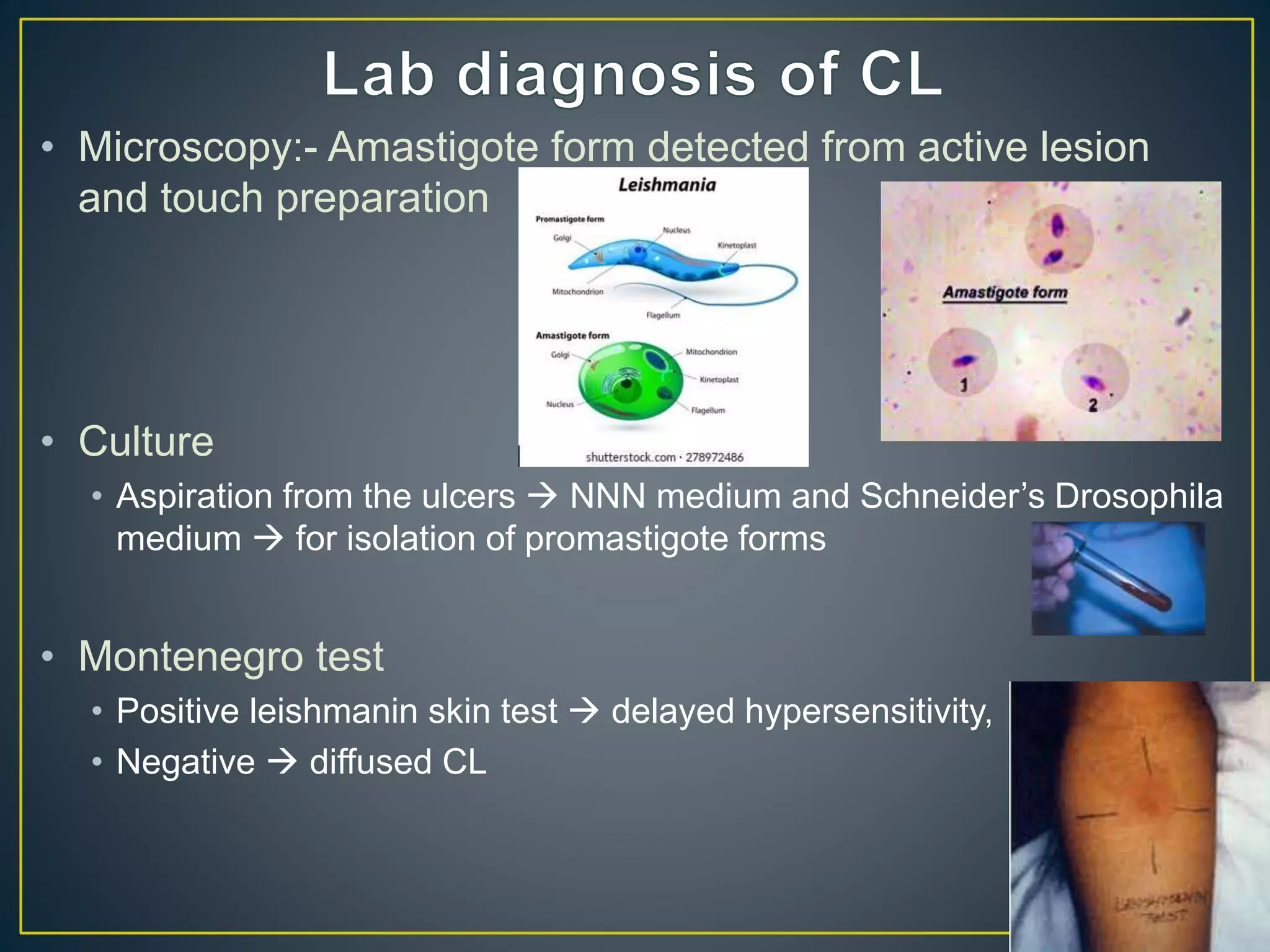Parasitic infection of Skin, Soft tissue and Muskuloskeletal tissues.pptx