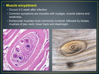 Parasitic infection of Skin, Soft tissue and Muskuloskeletal tissues.pptx