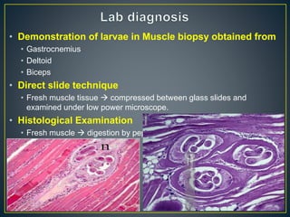 Parasitic infection of Skin, Soft tissue and Muskuloskeletal tissues.pptx