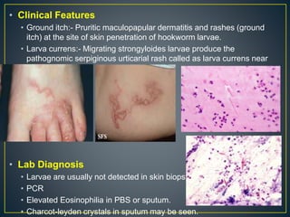 Parasitic infection of Skin, Soft tissue and Muskuloskeletal tissues.pptx
