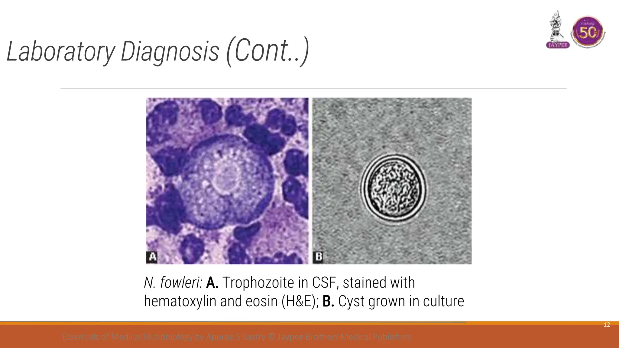 Parasitic Infections of CNS. Free living amoeba and ...