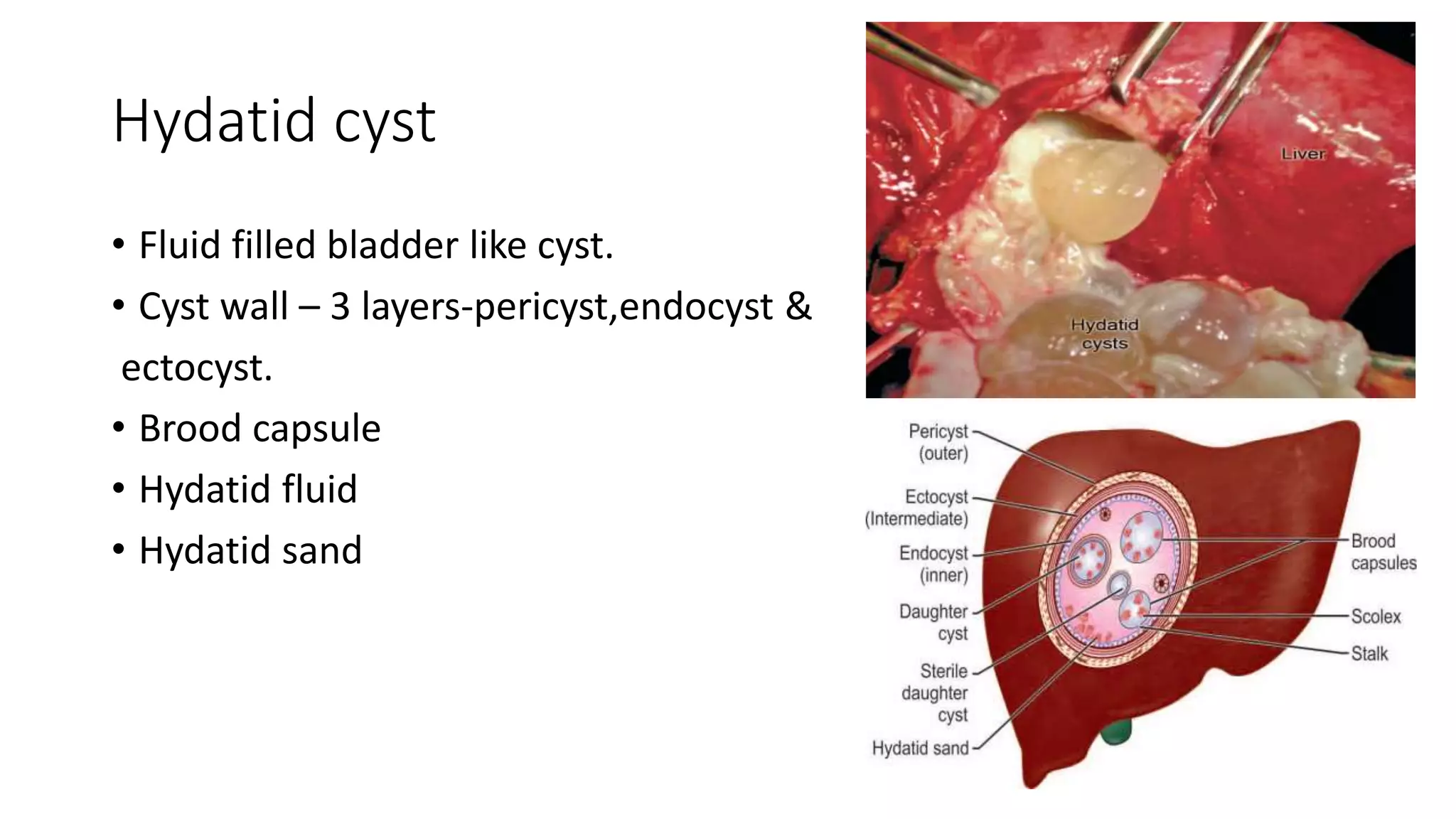 Parasitic infections of hepatobiliary system.pptx