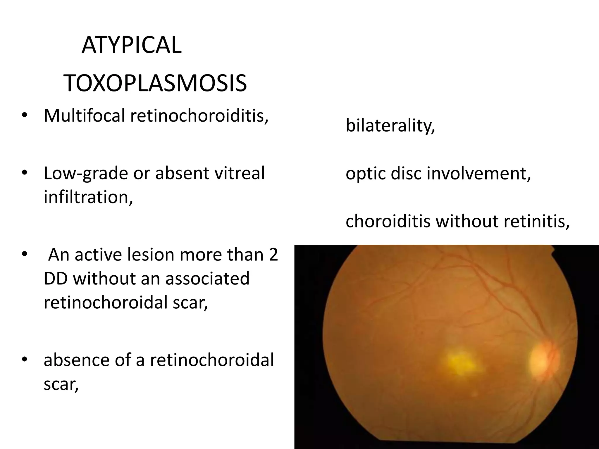 Parasitic infections of retina | PPTX