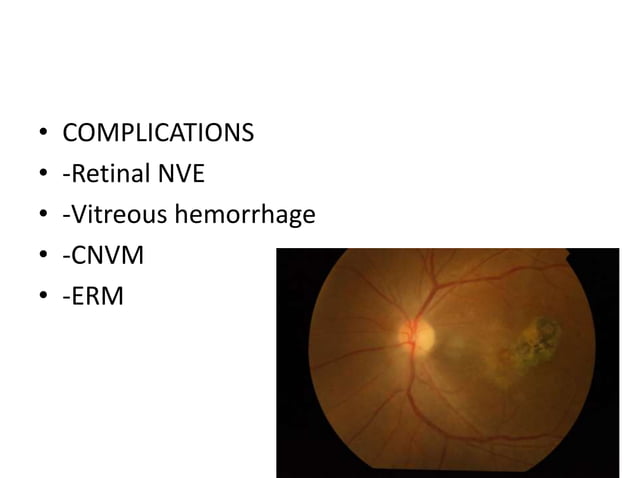 Parasitic infections of retina | PPTX | Eye and Vision Conditions ...