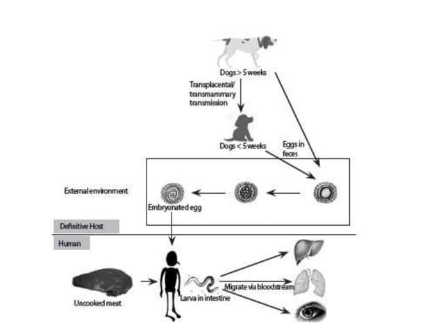 Parasitic infections of retina | PPTX | Eye and Vision Conditions ...