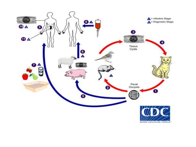 Parasitic infections of retina | PPTX | Eye and Vision Conditions ...