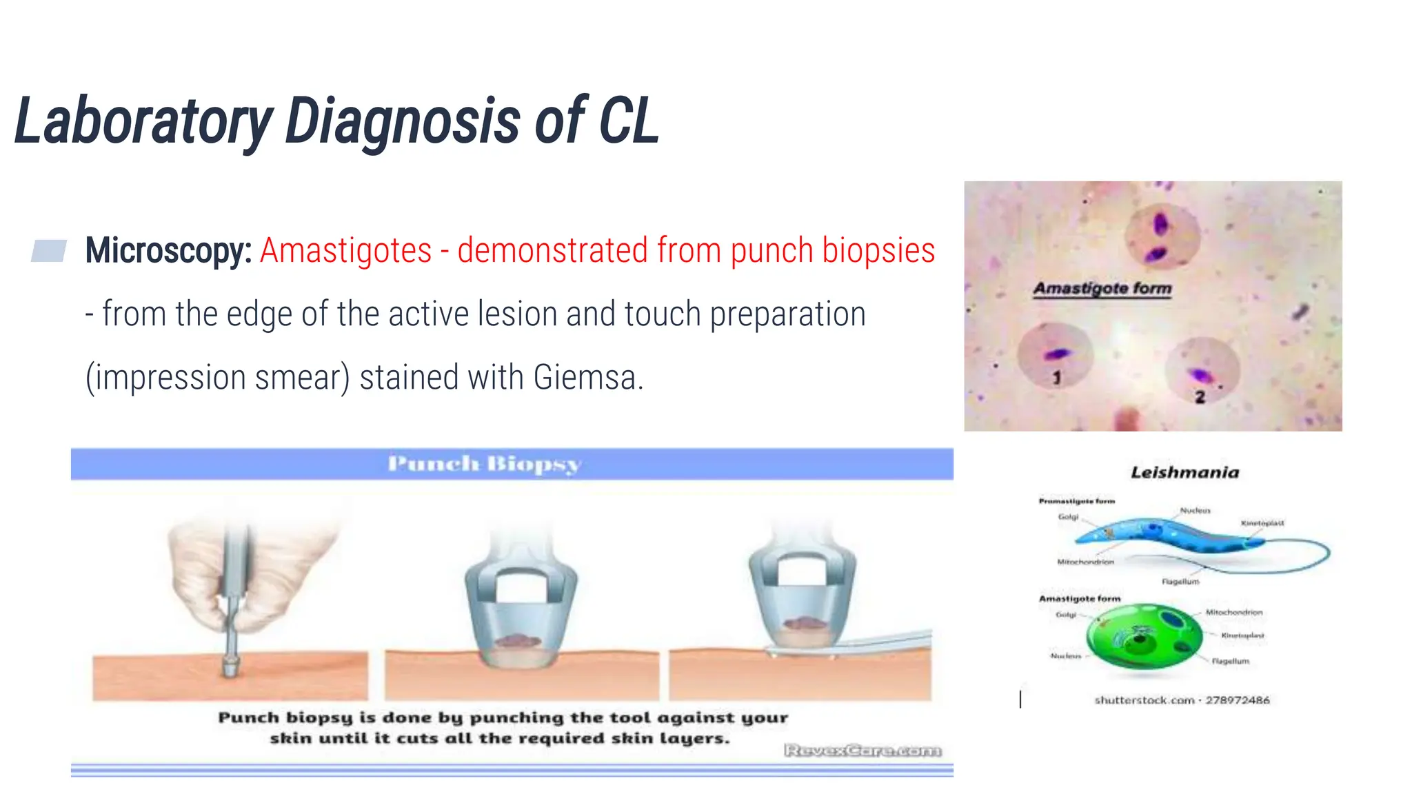 Parasitic Infections of Skin, Soft tissue and musculoskeletal system dr ...