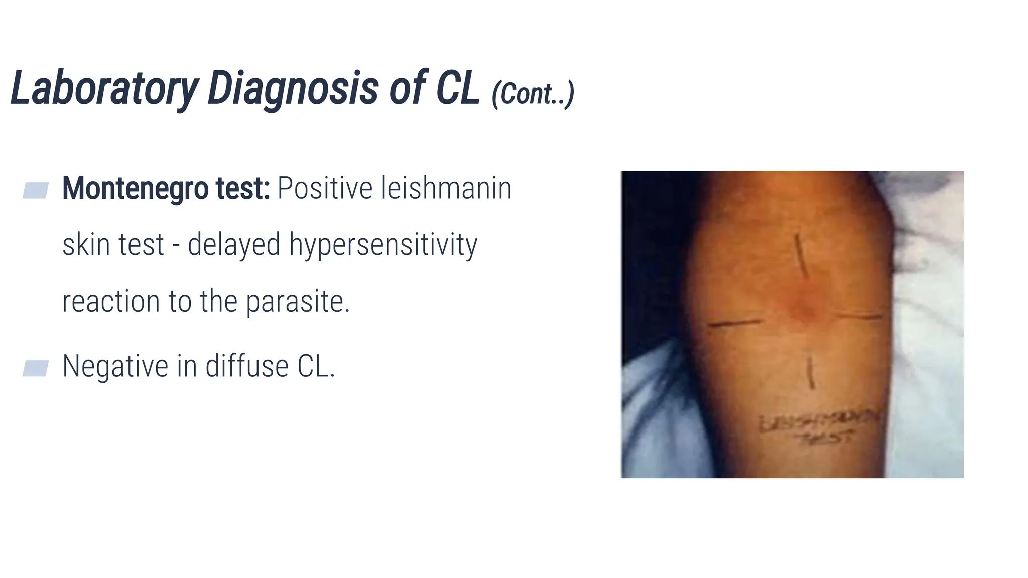 Parasitic Infections of Skin, Soft tissue and musculoskeletal system dr ...
