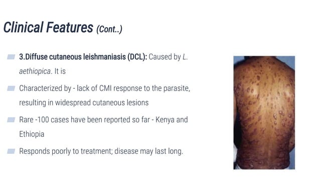 Parasitic Infections of Skin, Soft tissue and musculoskeletal system dr ...