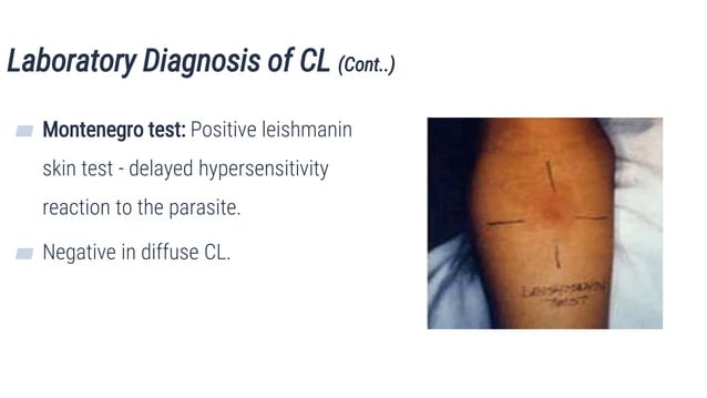 Parasitic Infections of Skin, Soft tissue and musculoskeletal system dr ...