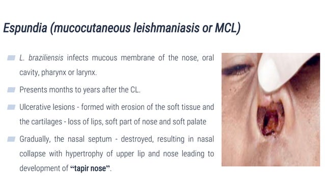 Parasitic Infections of Skin, Soft tissue and musculoskeletal system dr ...