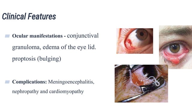 Parasitic Infections of Skin, Soft tissue and musculoskeletal system dr ...