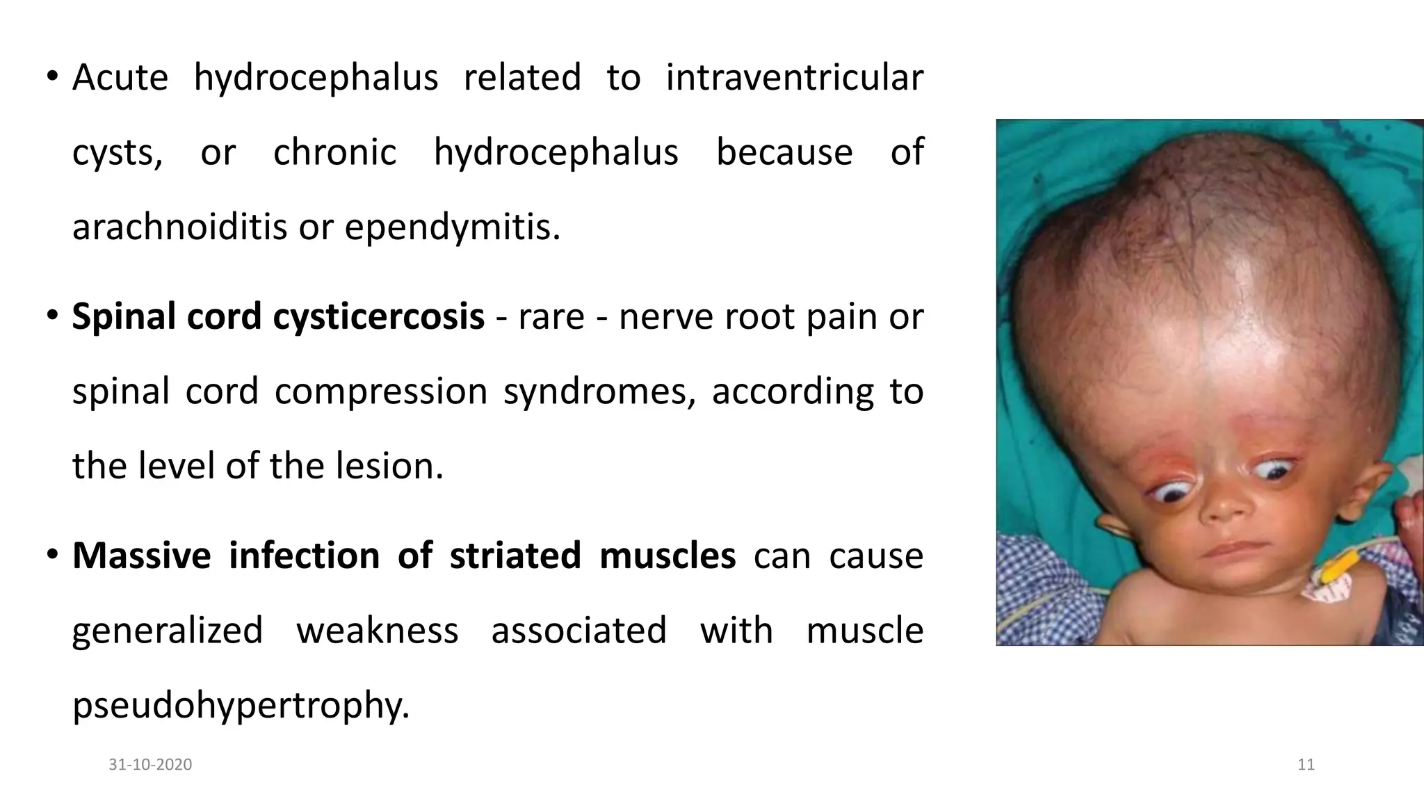 Parasitic neuro infections | PPTX