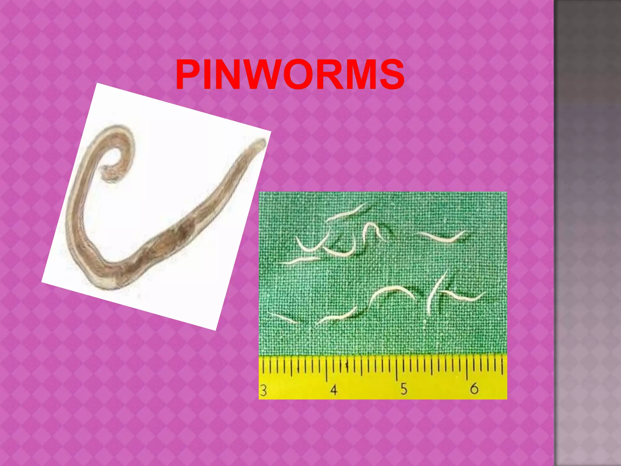 Parasitic worms or helminth senglish | PPTX