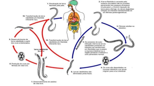 Parasitologia - Estrongiloidíase