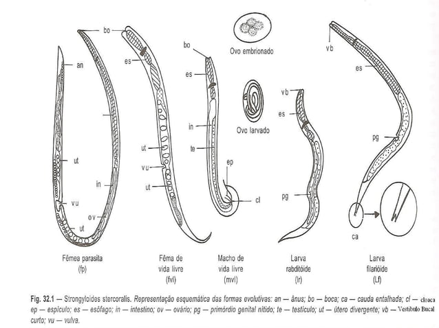 Strongyloides stercoralis hyperinfection in a patient with aids