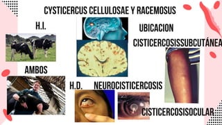 Parasitologia clase eucestoda de phylum platyhelmintes de genero ...